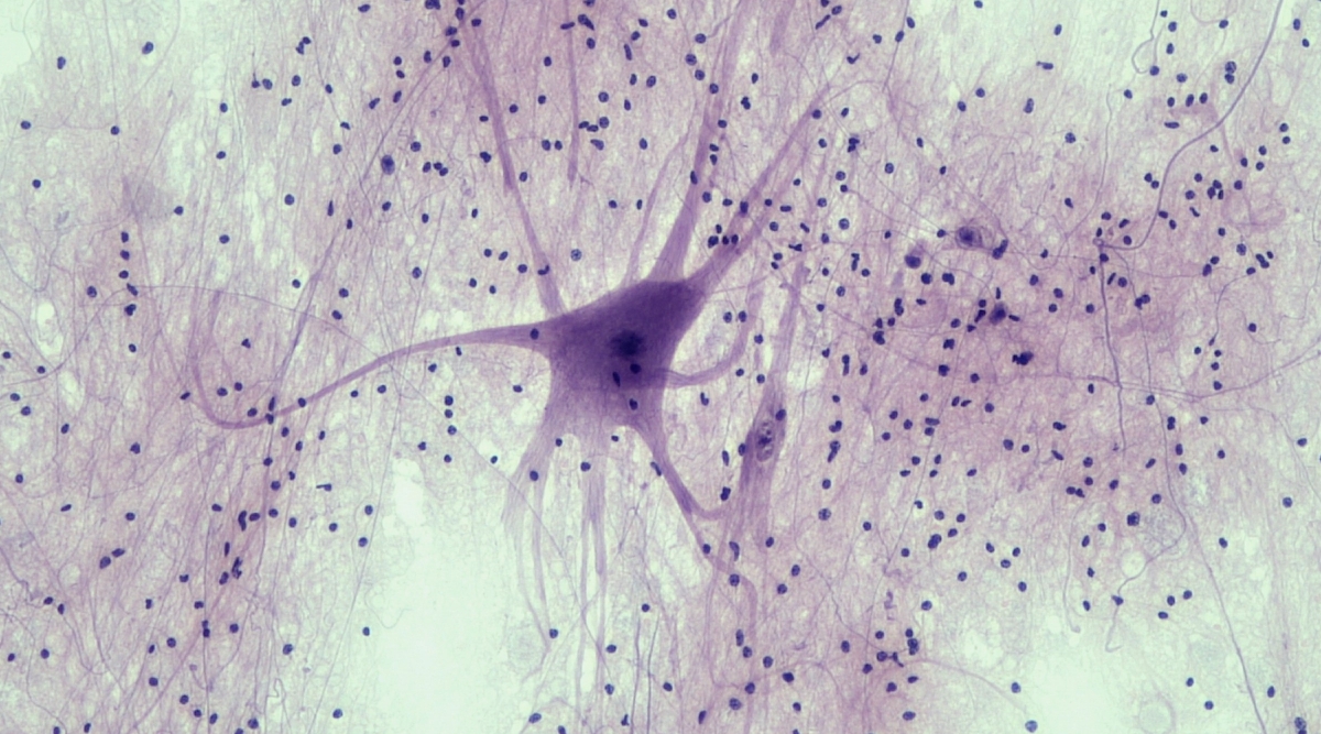 Researchers Create Functional 3D-Printed Brain Tissue for Neurological ...